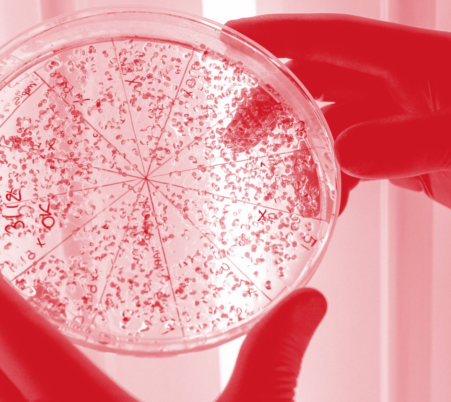 Infecciones bacterianas graves - Fundación Lucha contra las Infecciones